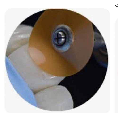 3M ESPE SOF-LEX DİSK REF: 8692M 50 LİK PAKETLERDE