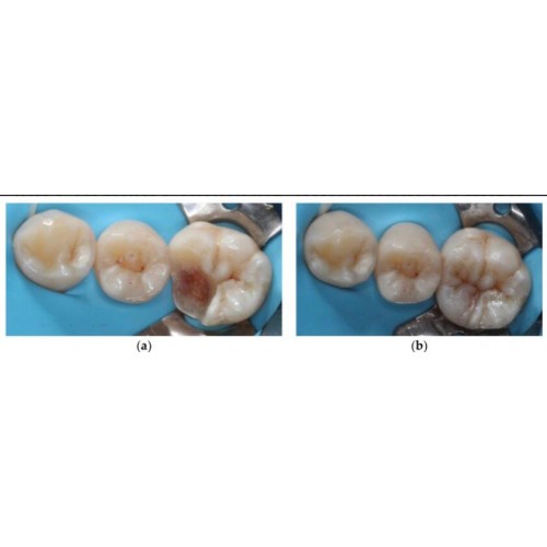 3M ESPE FİLTEK P60 POSTERİOR RESTORATİF TÜP 4 GR RENK C2